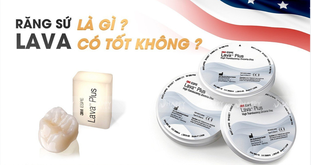 BỌC RĂNG SỨ LAVA PLUS CÓ TỐT KHÔNG? GIÁ BAO NHIÊU? ƯU-NHƯỢC ĐIỂM LÀ GÌ ...
