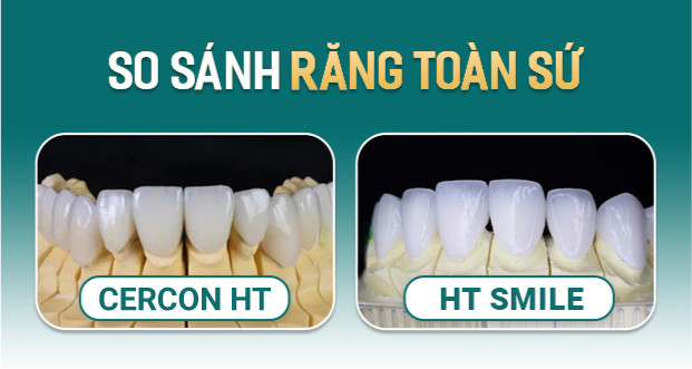 BỌC RĂNG SỨ LOẠI NÀO TỐT: CERCON HT HAY HT SMILE? - Review Nha Khoa ...
