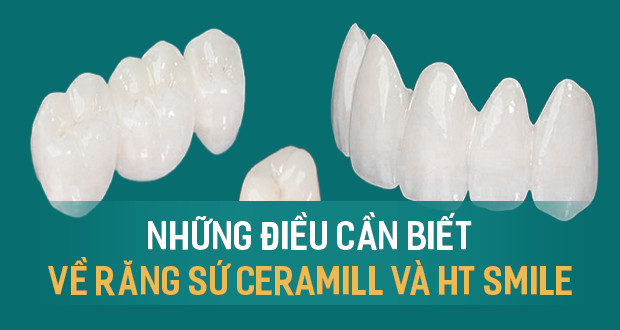 NHỮNG ĐIỀU CẦN BIẾT VỀ RĂNG SỨ CERAMILL VÀ HT SMILE - Review Nha Khoa ...