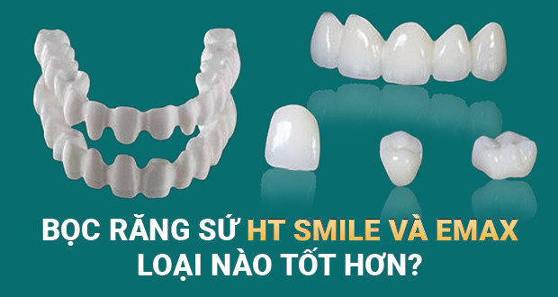 BỌC RĂNG SỨ HT SMILE VÀ EMAX LOẠI NÀO TỐT HƠN? - Review Nha Khoa Việt Nam